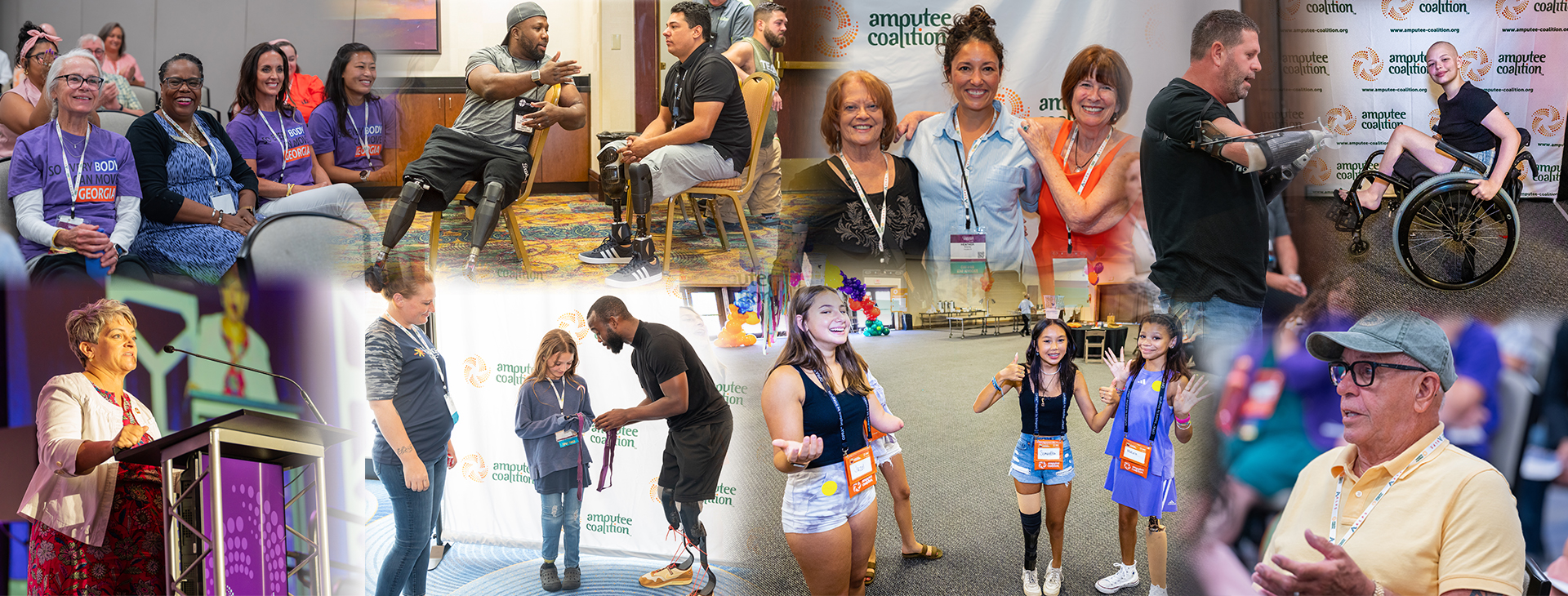 Find Support Services – Amputee Coalition